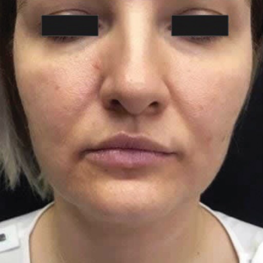 Jovena launches in Australia - Aesthetic Medical Practitioner