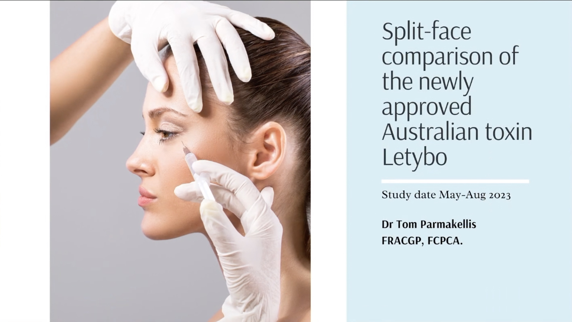 Split face toxin comparison - Dr Tom Parmakellis - Aesthetic Medical ...
