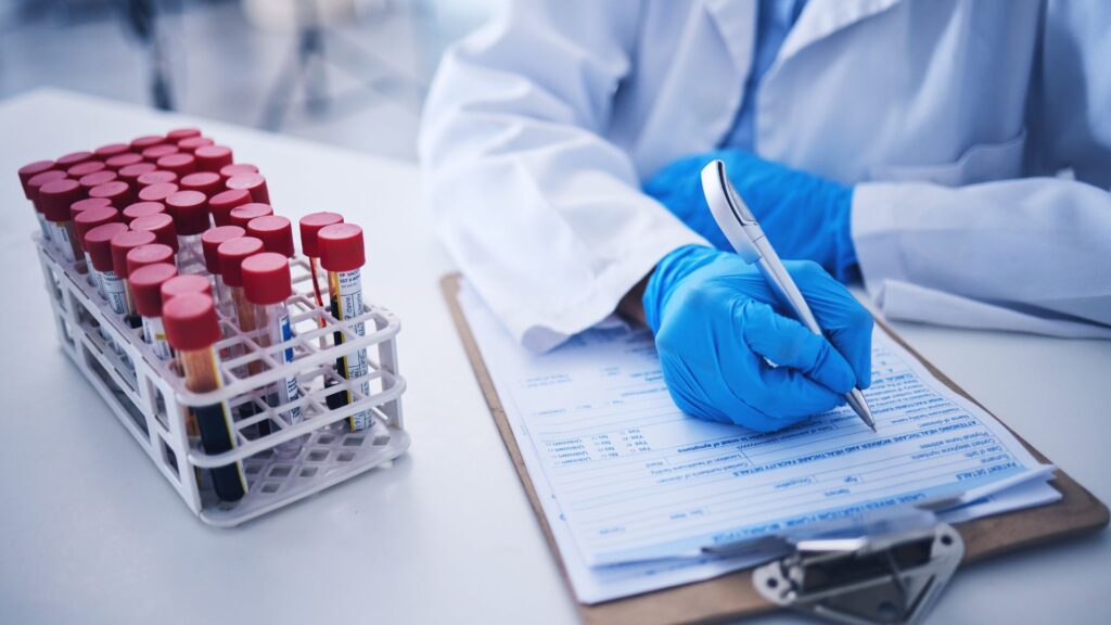 Blood test 90% accuracy to identify Alzheimer’s - Aesthetic Medical ...