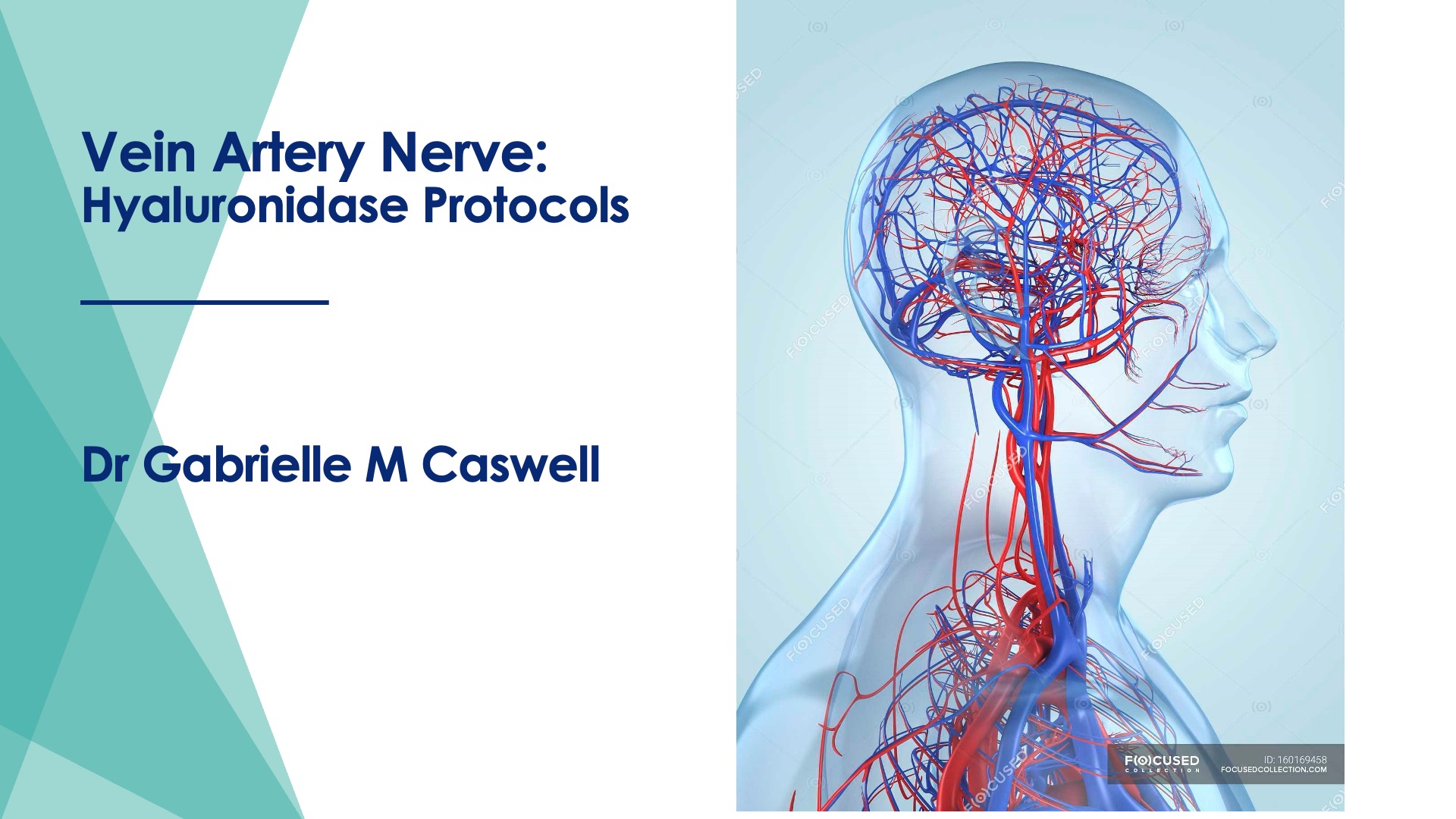 Vein, Arteries and Nerve knowledge is needed when you 'Hyaluronidase ...