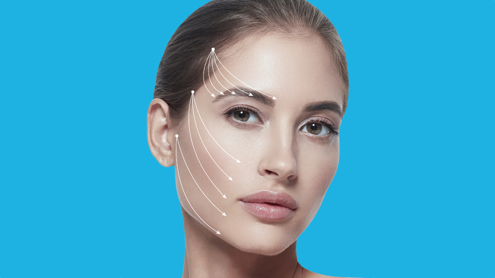 APTOS Threads markings - Aesthetic Medical Practitioner