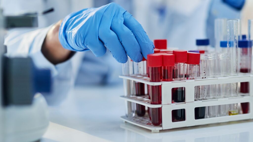 Blood test to assess lifespan - Aesthetic Medical Practitioner